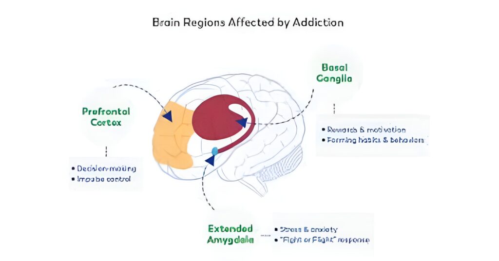 Understanding the Brain's Response to Addiction: Can It Be Reversed?